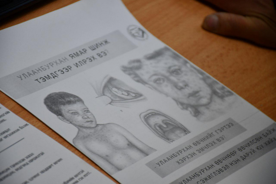 Вакцин хийлгээгүй хүүхдүүд улаан бурхан тусаж байна